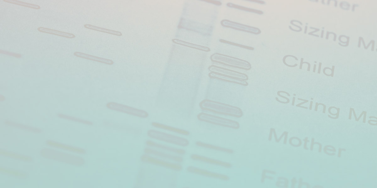 How Fast is Technology Accelerating?