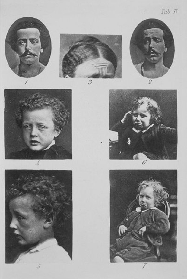 How Darwin's Photos of Human Emotions Changed Visual Culture - The Atlantic