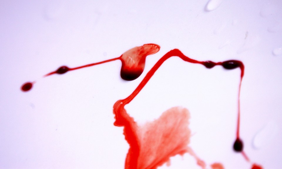 Surgery Without Blood Transfusions: The Advent of Bloodless Medicine ...