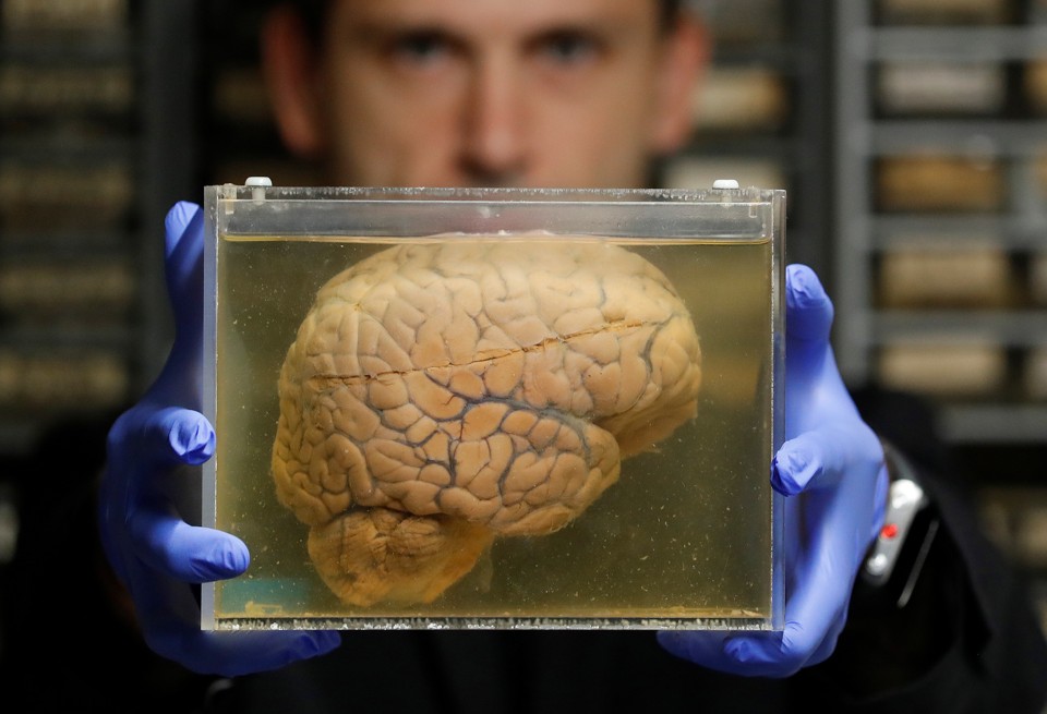 Why Philosophers Are Obsessed With Brain in Jars - The Atlantic