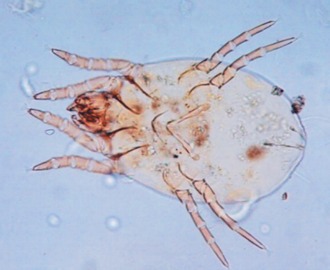 Befriending the Dust Mites Living in Your Ear - The Atlantic