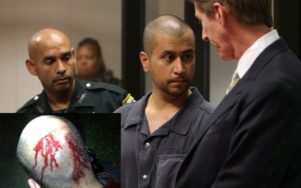 Photo Shows Blood on George Zimmerman's Head After Martin Shooting ...