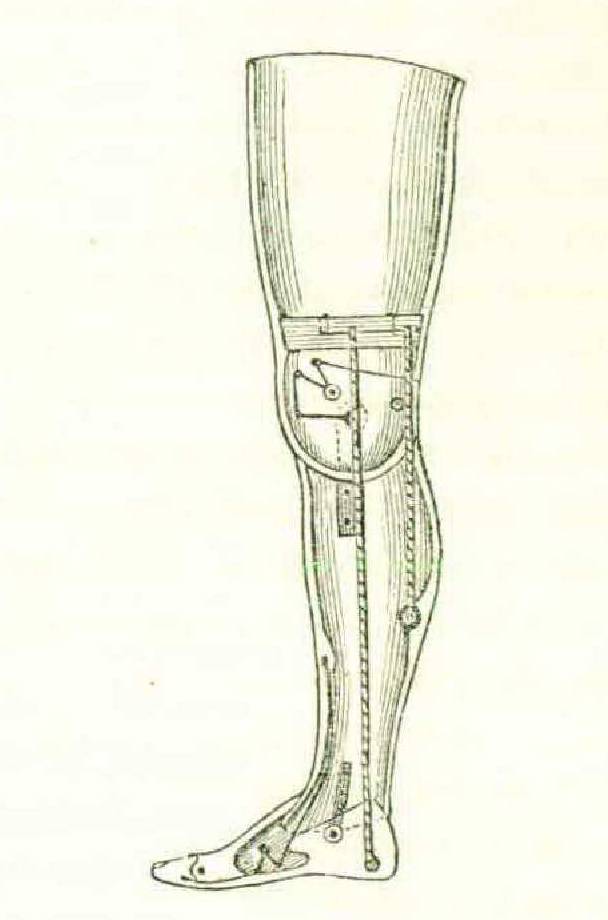 The Human Wheel, Its Spokes and Felloes - The Atlantic