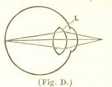 Weak Sight - The Atlantic