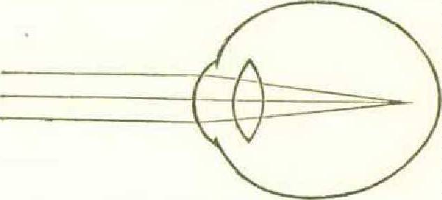 Weak Sight - The Atlantic