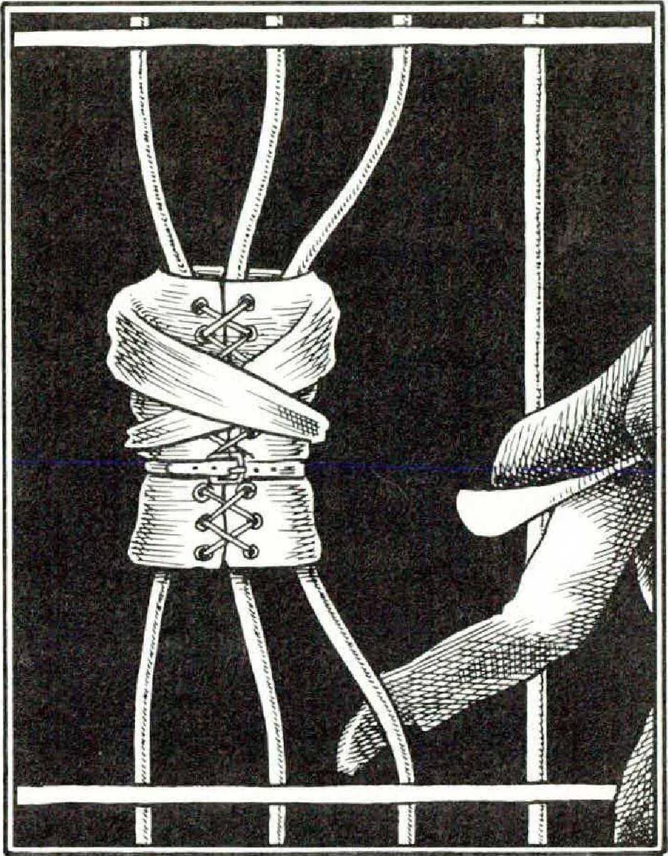 Law: The Epilepsy Defense - The Atlantic