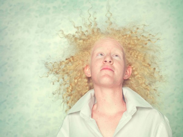 Albinism, in Portraits - The Atlantic