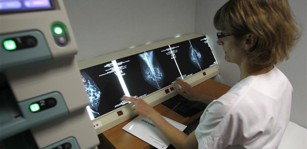 U.S. Health Panel Takes Heat on Cancer Screening Advice - The Atlantic