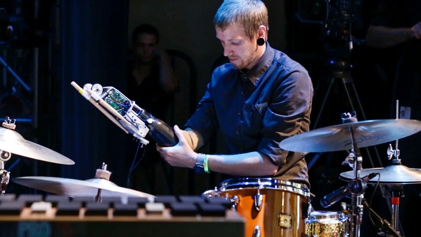 The Cyborg Drummer: How a Robot Hand Gave a Musician His Groove Back ...