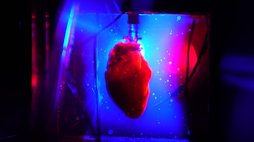 The H1B Visa Uncertainty Surrounding President Trump’s Executive Order ...