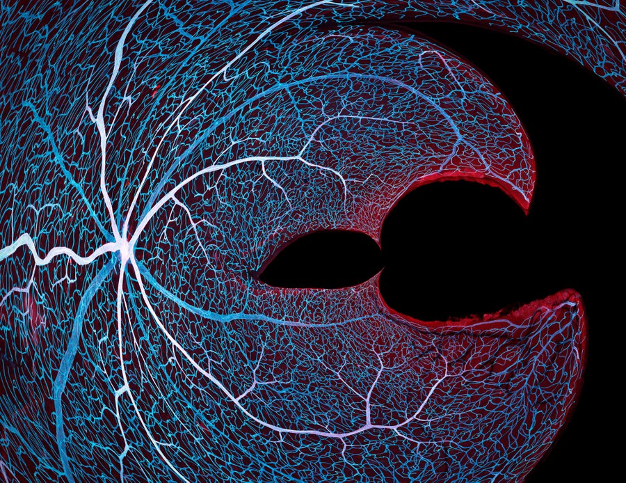 Photographing the Microscopic: Winners of Nikon Small World 2021 - The ...