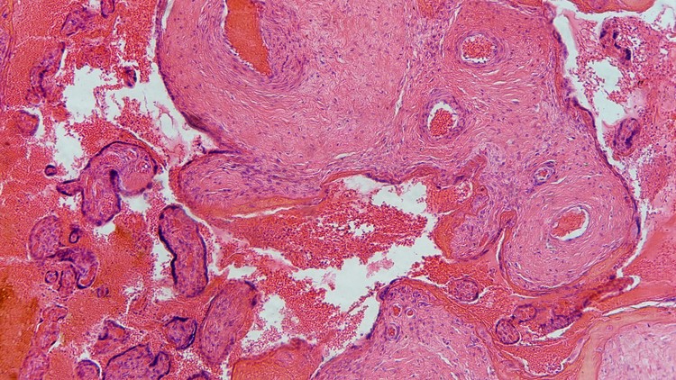 Should I Eat My Placenta? - The Atlantic