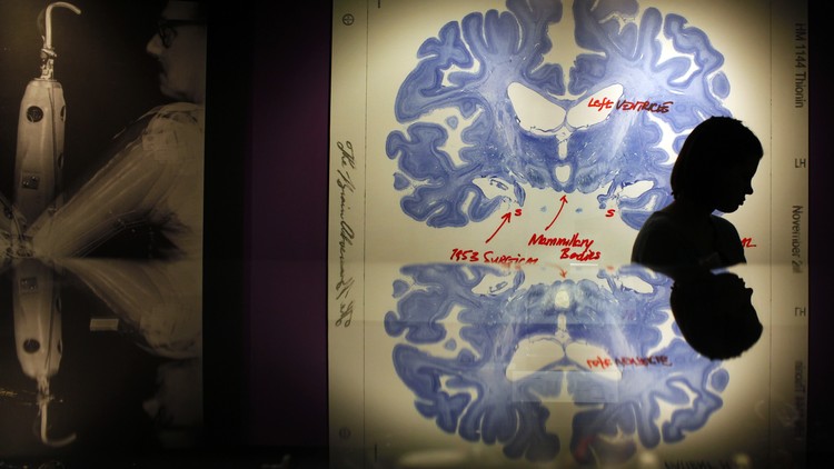 A Book About Neuroscience’s Most Famous Patient Sparks Controversy ...