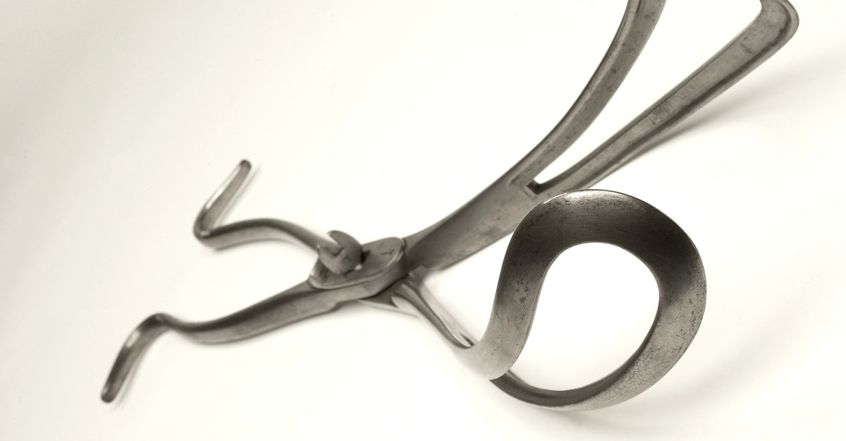 forceps birth nhs