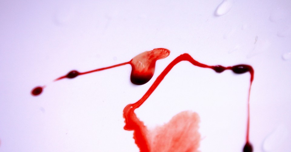 Surgery Without Blood Transfusions: The Advent of Bloodless Medicine ...