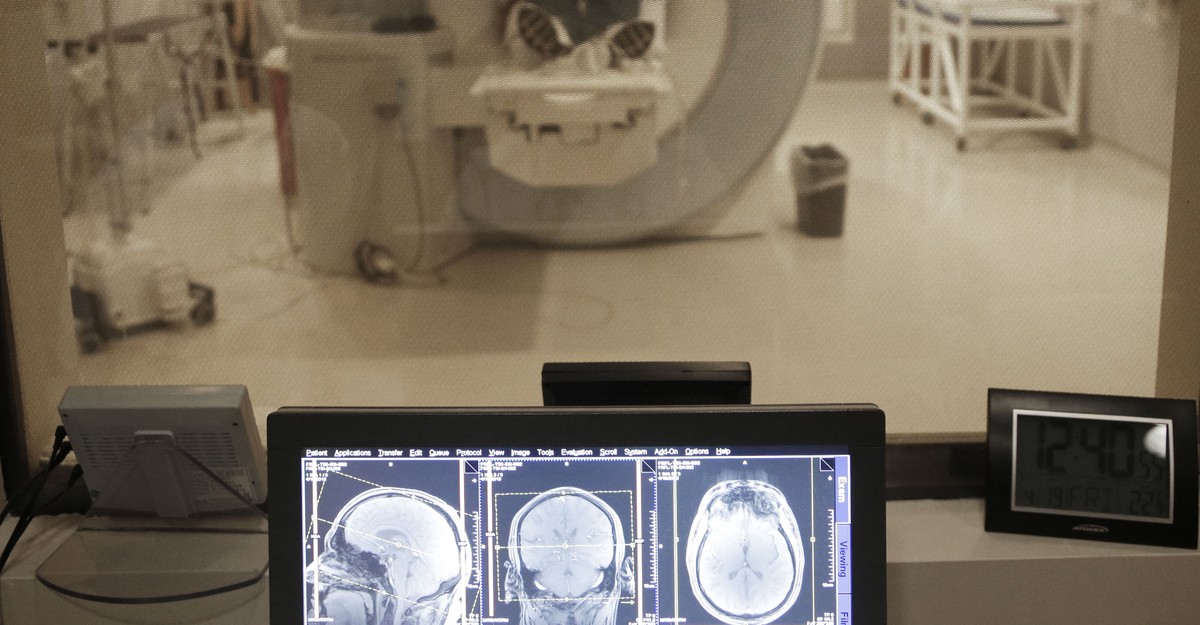 Brain Volume Could Reveal Signs of CTE in the Living - The Atlantic