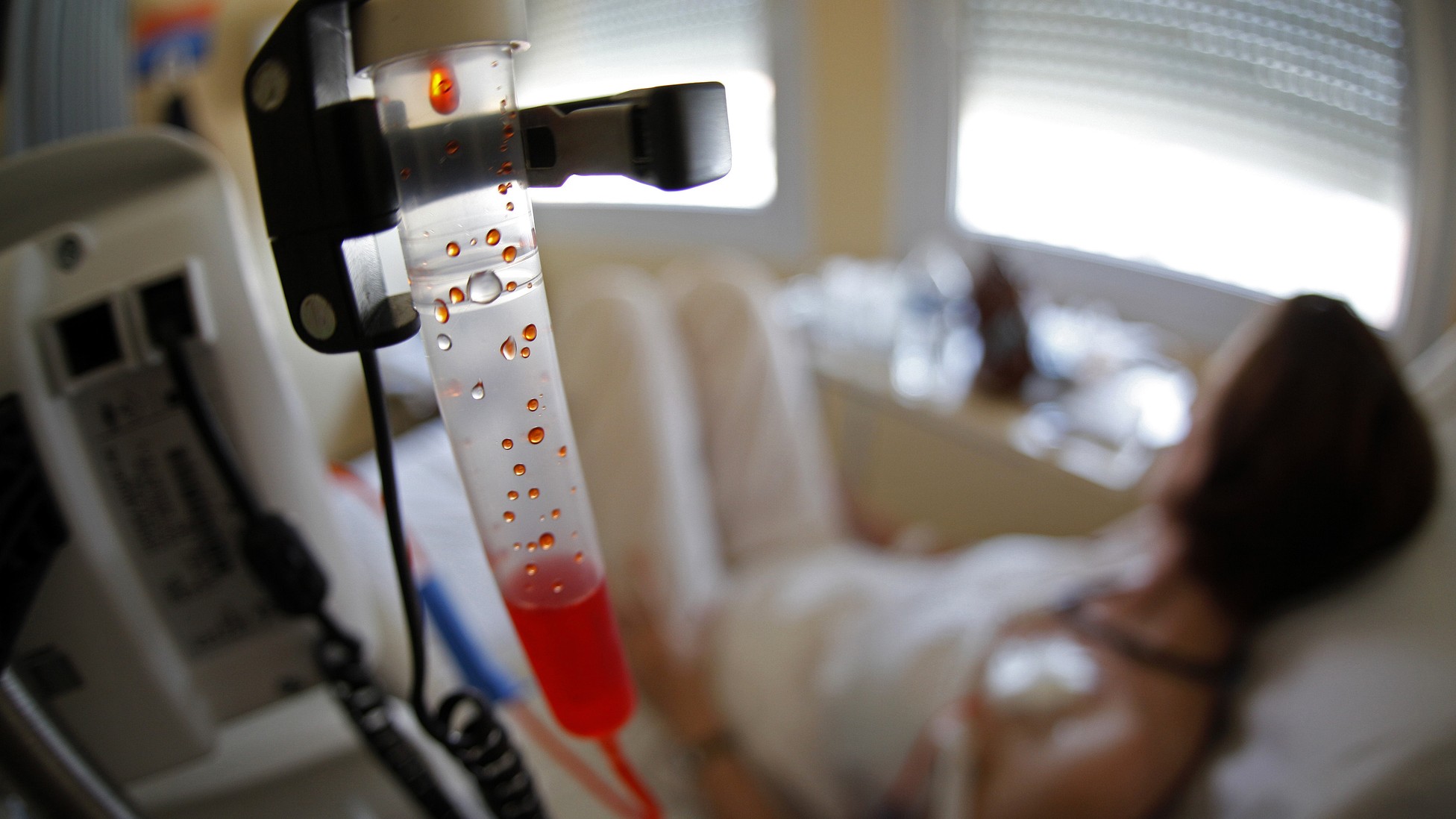 The Medical Port: An Implant That Helps Fight Cancer - The Atlantic