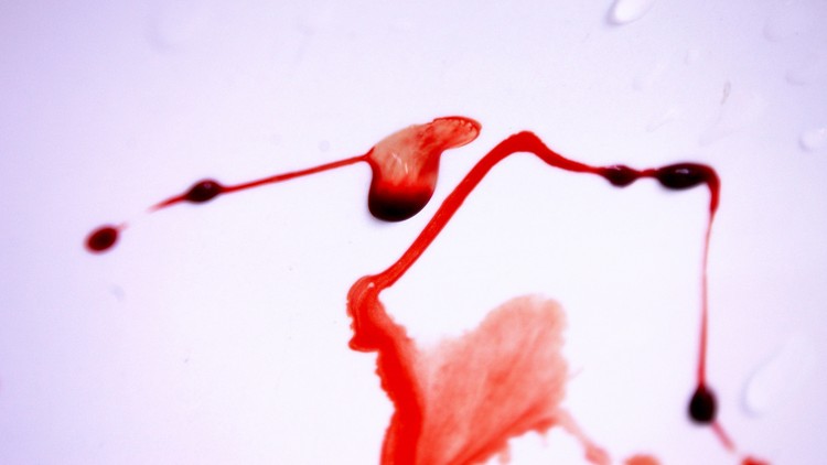 Surgery Without Blood Transfusions: The Advent of Bloodless Medicine ...