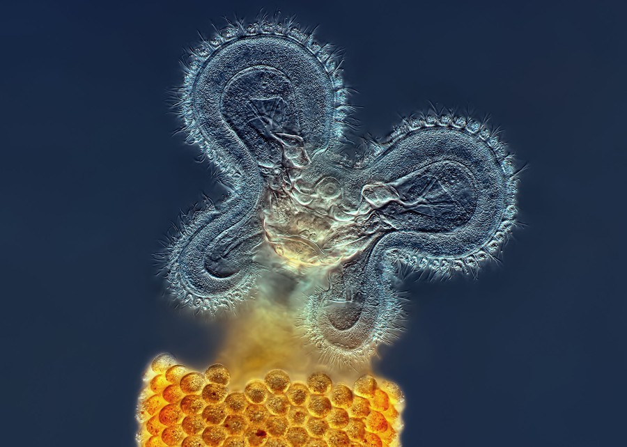 Photographing the Microscopic: Winners of Nikon Small World 2018 - The ...