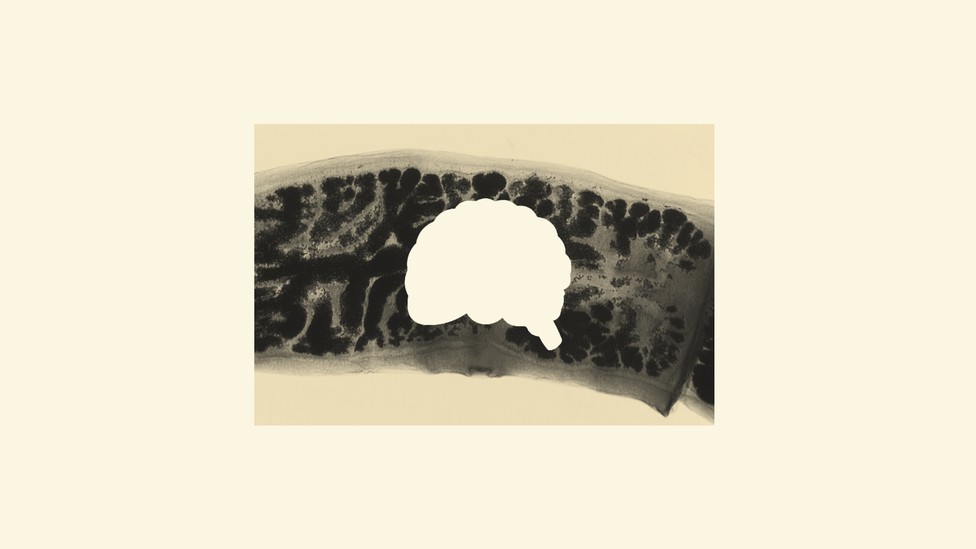 Who Really Has Brain Worms? - The Atlantic