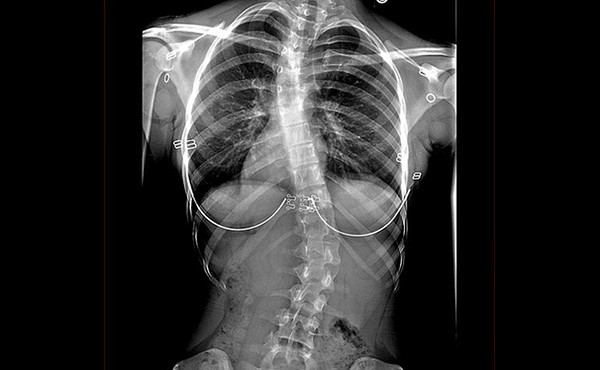 All Stories by Rachel Rabkin Peachman - The Atlantic