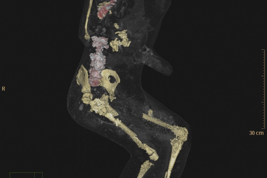 In Photos: The Ancient Civilization With Perfect Teeth - The Atlantic