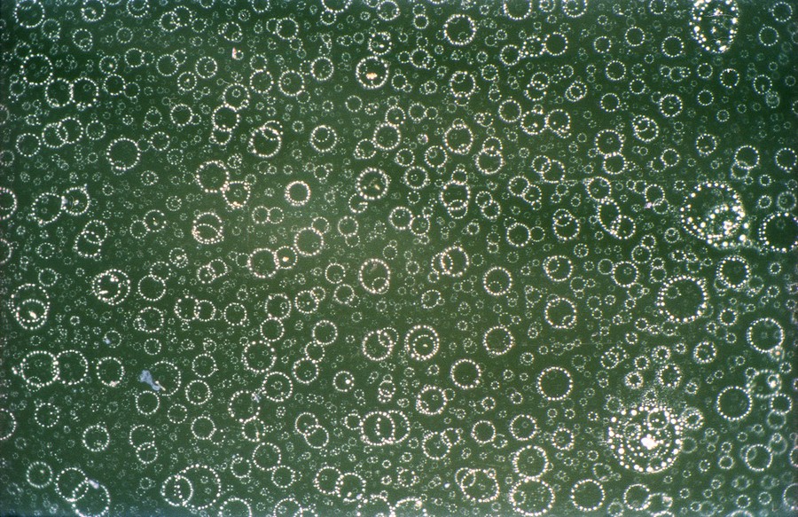 Life Under the Microscope - The Atlantic