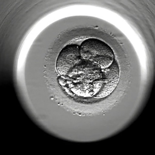 The People Rooting for the End of IVF - The Atlantic