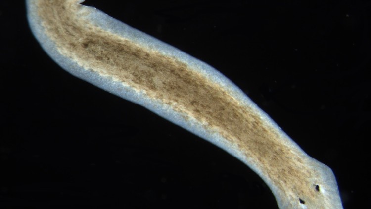 Decapitated Worms Get Better, See Again - The Atlantic