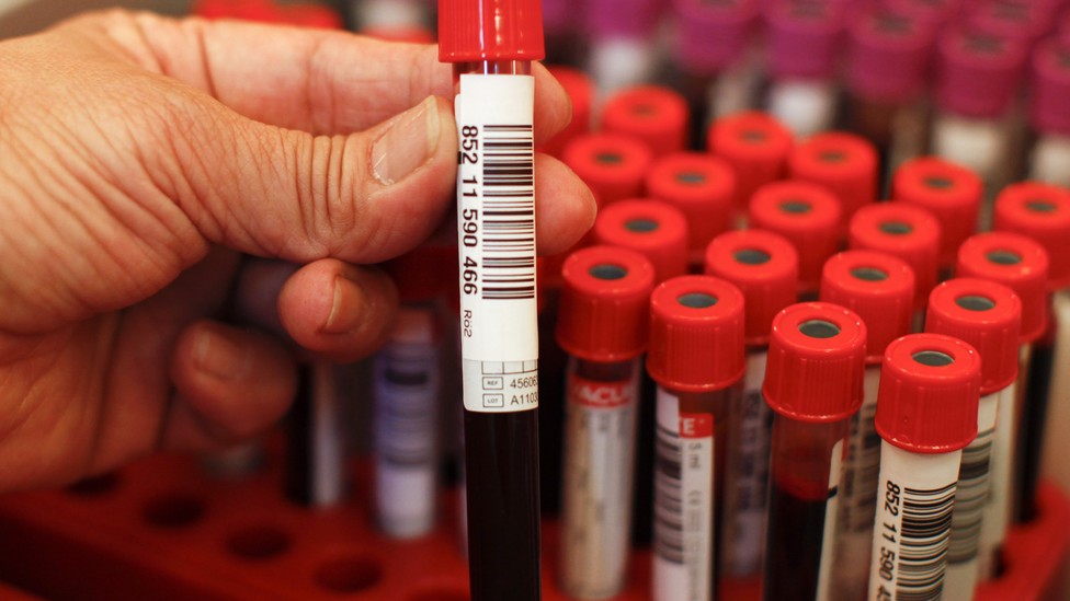 Blood From Human Umbilical Cords Can Rejuvenate Old Mouse Brains - The ...