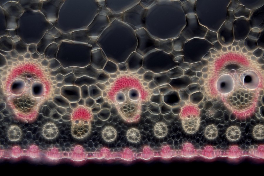 Photographing the Microscopic: Winners of Nikon Small World 2015 - The ...