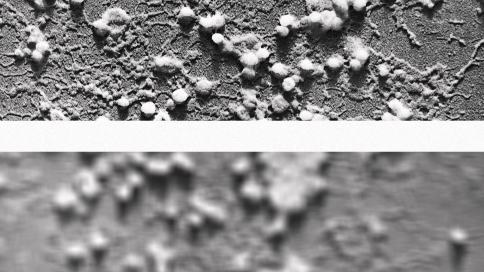 flu type a under microscope