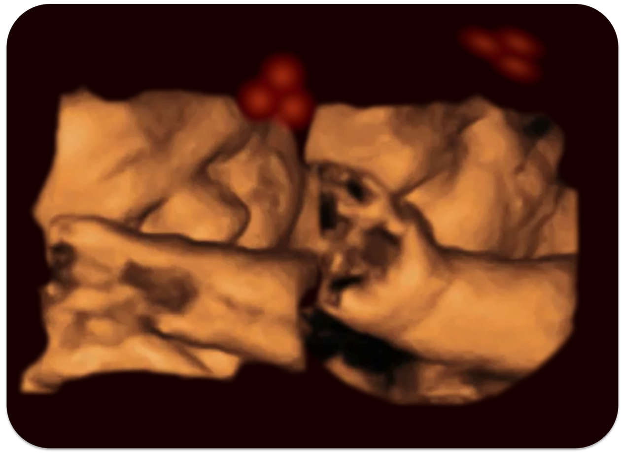 Study: Fetuses Prefer Face-Like Images Even in the Womb - The Atlantic