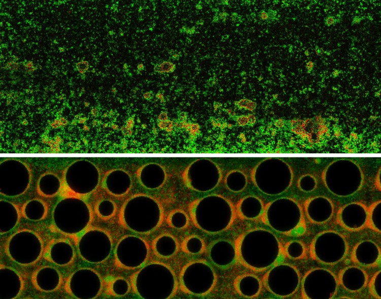 The Architecture of Bacterial Biofilms - The Atlantic