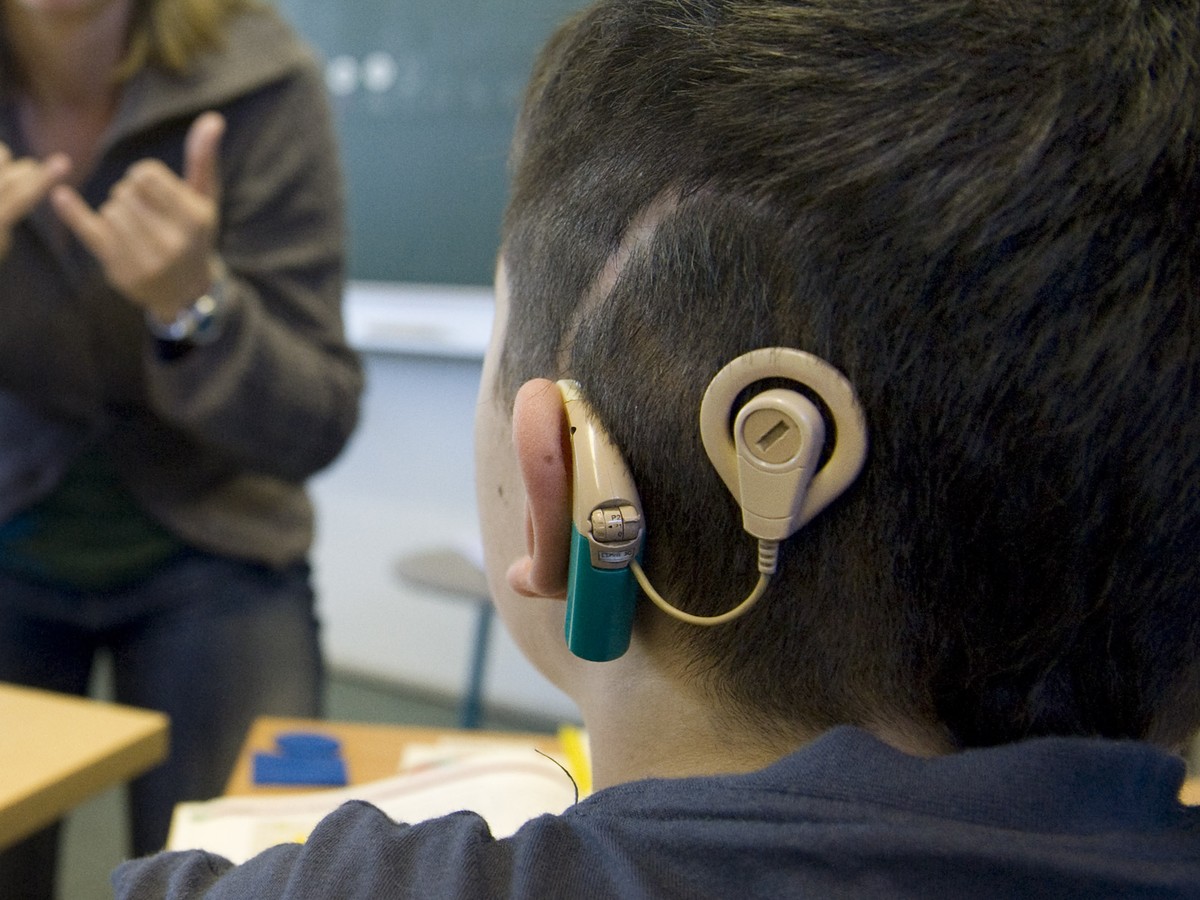 Freedom Cochlear Implant