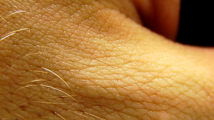 Morgellons: Diagnosis or Delusion? - The Atlantic