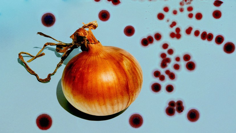 America Has an Onion Problem - The Atlantic