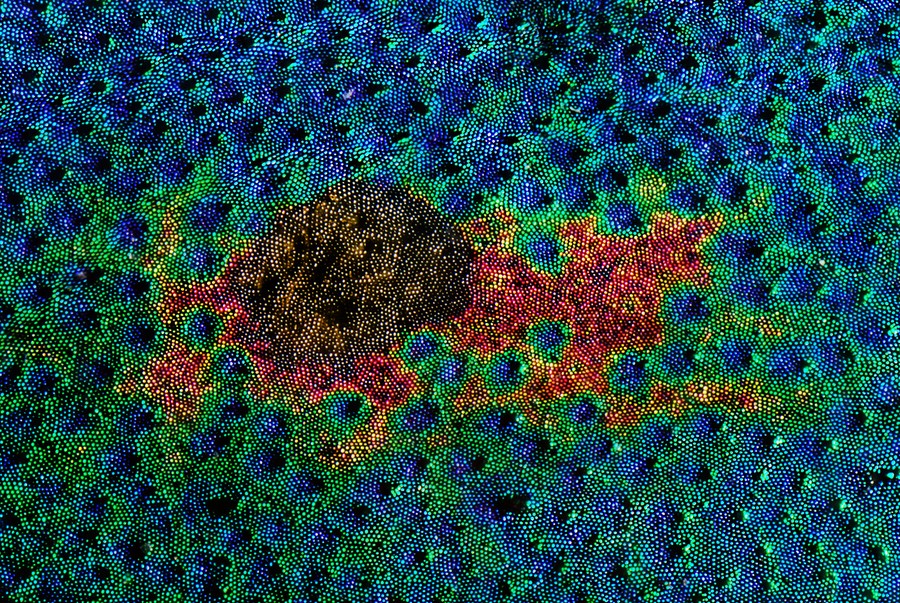 Life Under the Microscope - The Atlantic