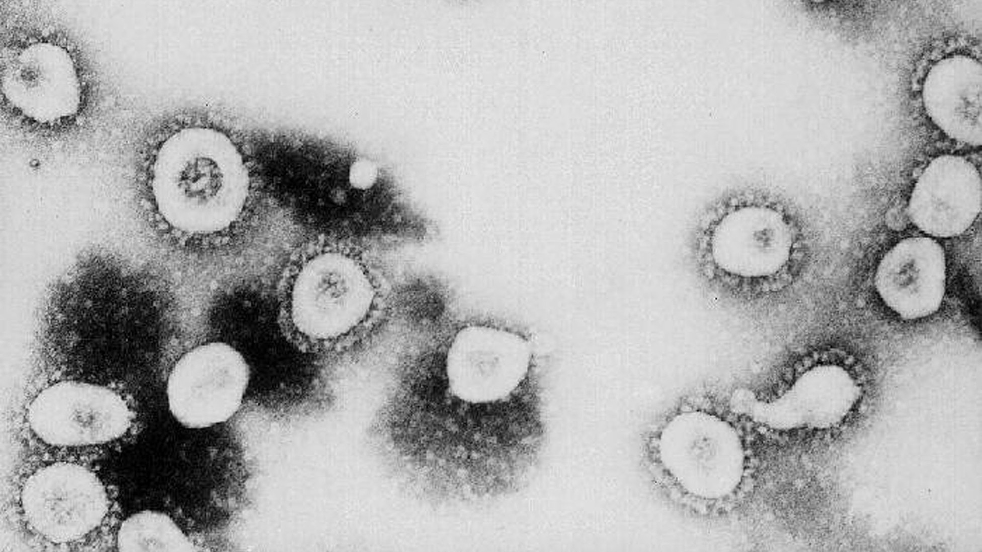 Poor Countries Are the Front Line Against Coronavirus - The Atlantic