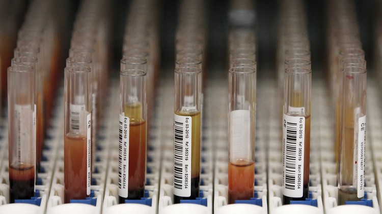 What Happens When a Genetic Test Is Wrong - The Atlantic