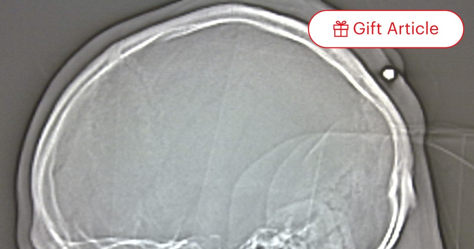 how bullet affect body