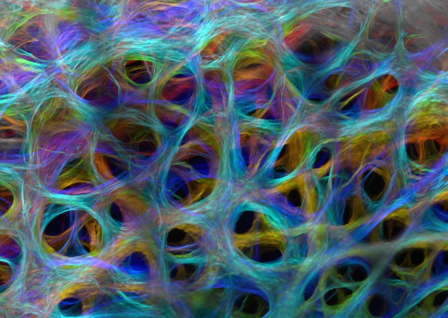 Photographing the Microscopic: Winners of Nikon Small World 2024 - The ...