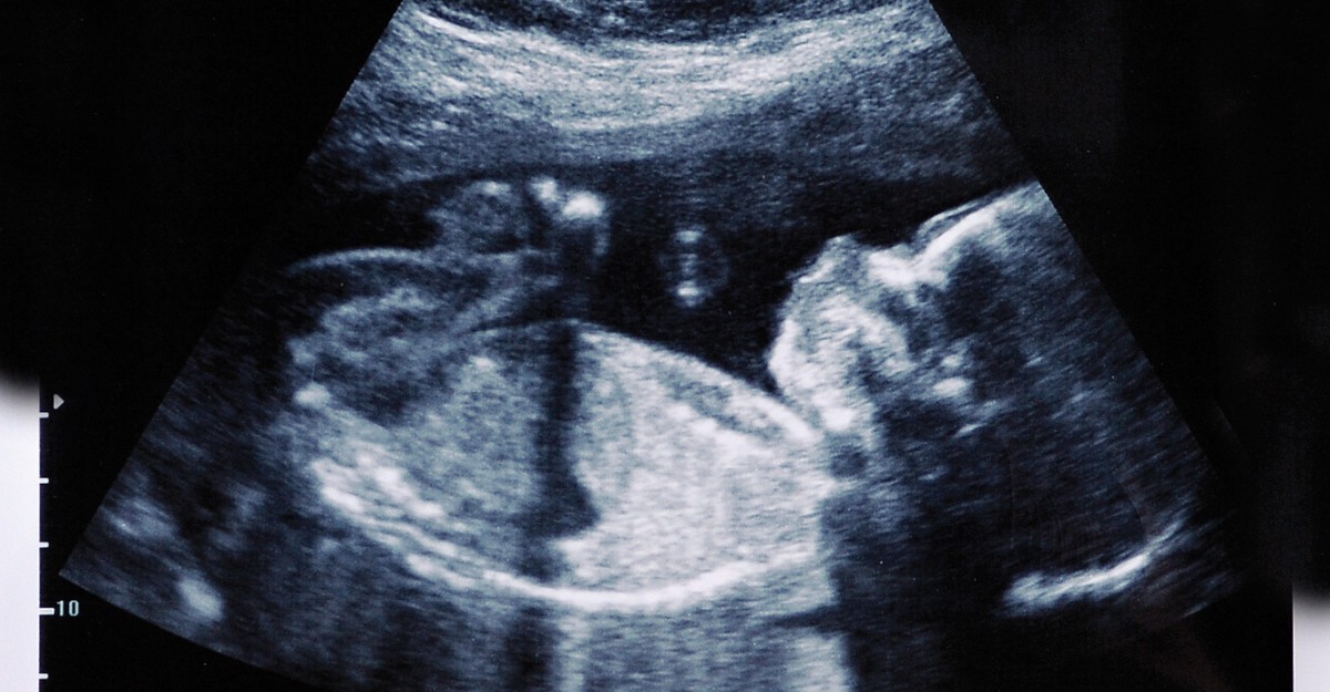 The Unexpected Ways a Fetus Is Shaped by a Mother's Environment - The ...