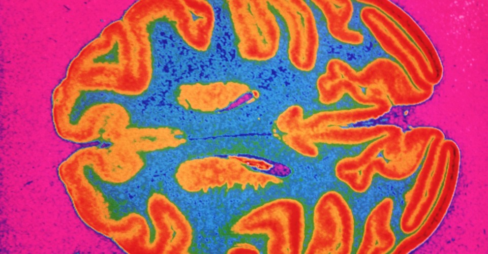 Are Male and Female Brains Biologically Different? - The Atlantic