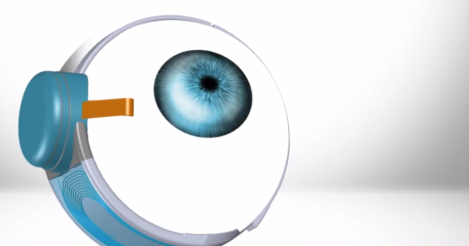 The Woman With the Bionic Eye - The Atlantic