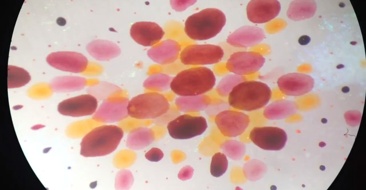 Watch Squid Cells Bump to Cypress Hill's 'Insane in the Brain' - The ...