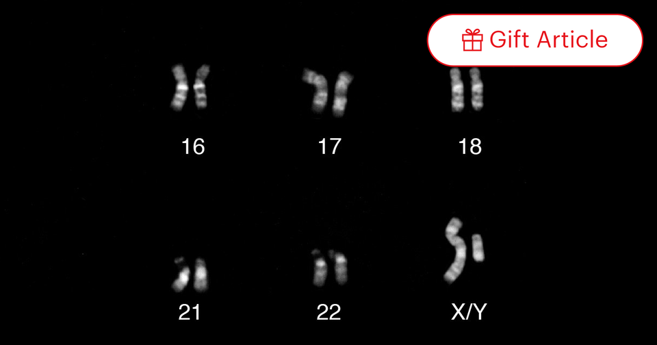 Y Chromosome Karyotype Male Karyotype Stock Image C022/0510