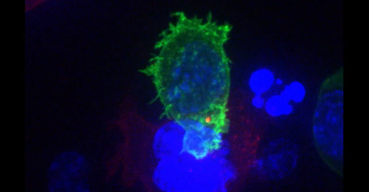 Amazing Microscopic Video Footage of a T Cell Attacking a Cancer Cell ...