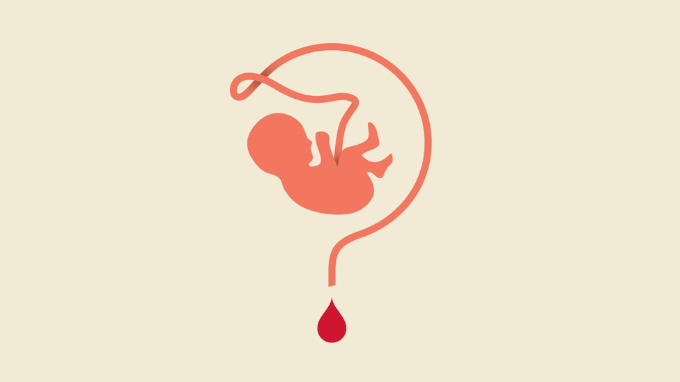 Is Cord-Blood Banking Worth It? - The Atlantic