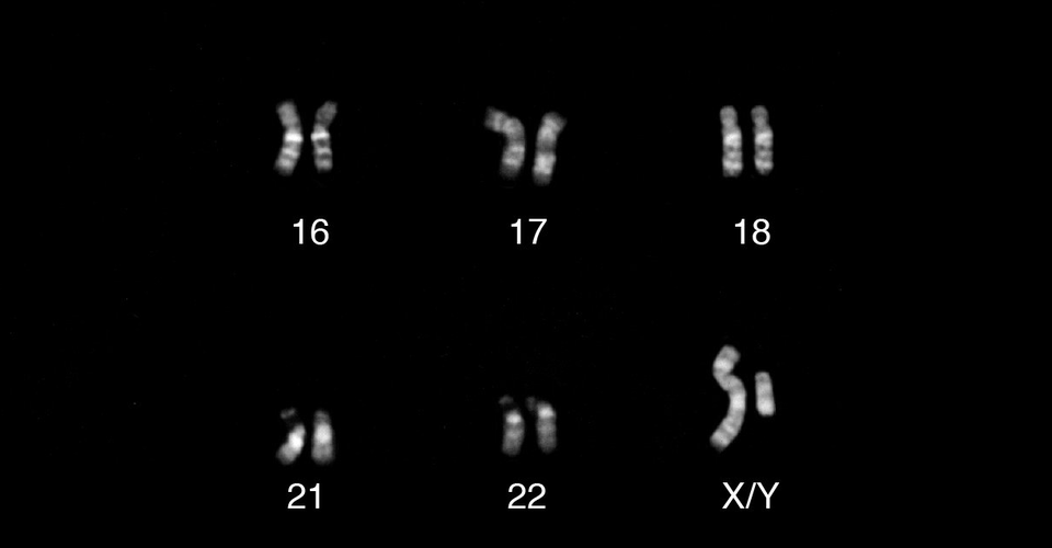The Y Chromosome's Remaining Unsequenced Regions - The Atlantic